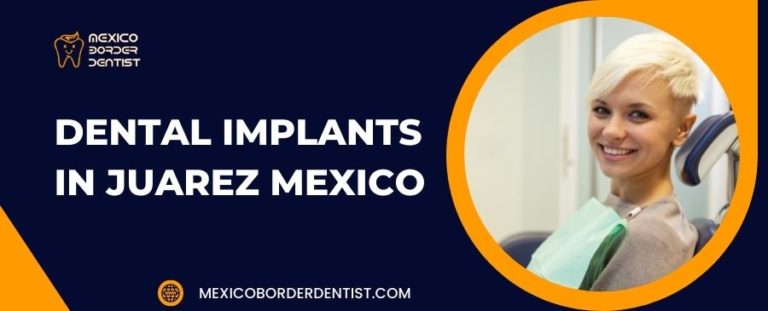 Dental Implants in Ciudad Juarez, Mexico - Top Clinics
