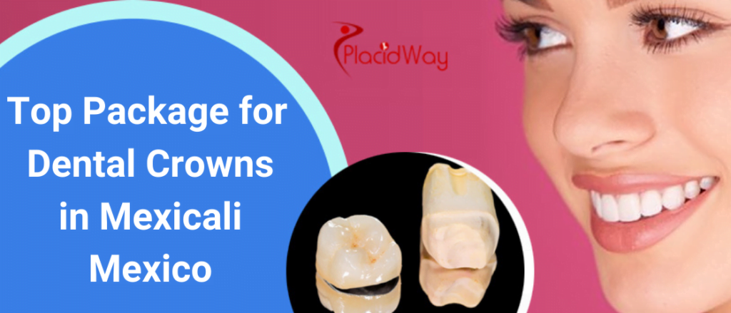 Dental crowns in Mexicali Mexico at affordable Cost